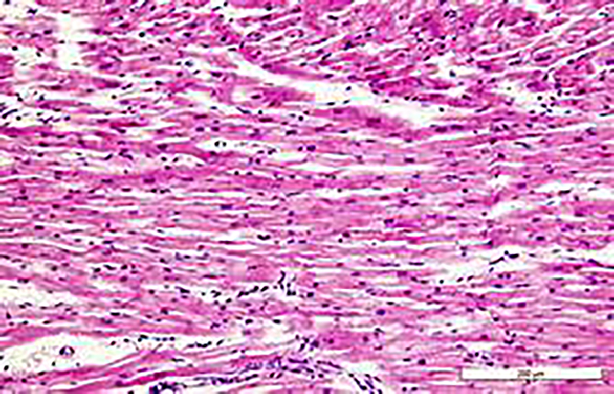 Regeneración cardíaca por inducción de cardiomiocitos posterior a ...